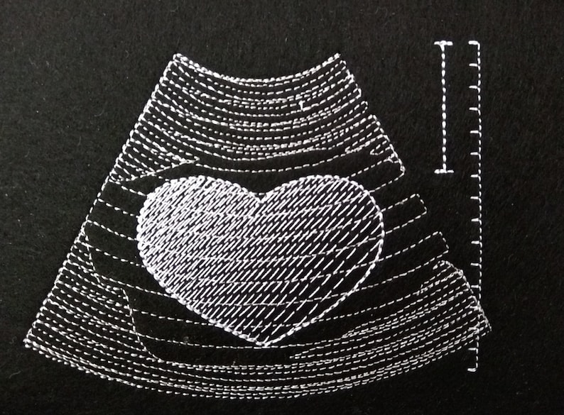 LOVE Ultrasound Tech Pocket Machine Embroidery Applique - Etsy