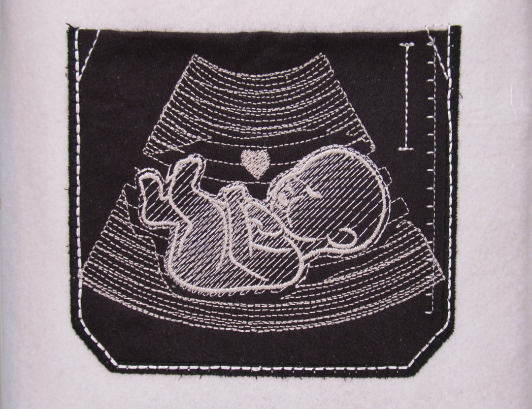 Ultrasound Tech Doctor Pocket With Baby Image Picture - Machine ...