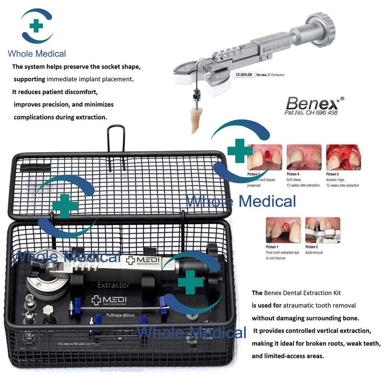 BENEX II Extraction System Full Kit for Atraumatic Tooth Removal - Etsy