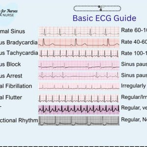 ECG Rhythm Guide for Nurses: EKG Cheat Sheet (digital Download) - Etsy
