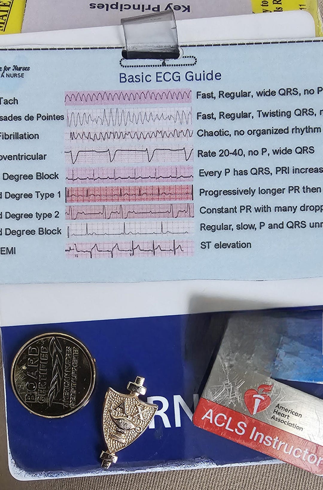 ECG Rhythm Guide for Nurses: EKG Cheat Sheet (digital Download) - Etsy