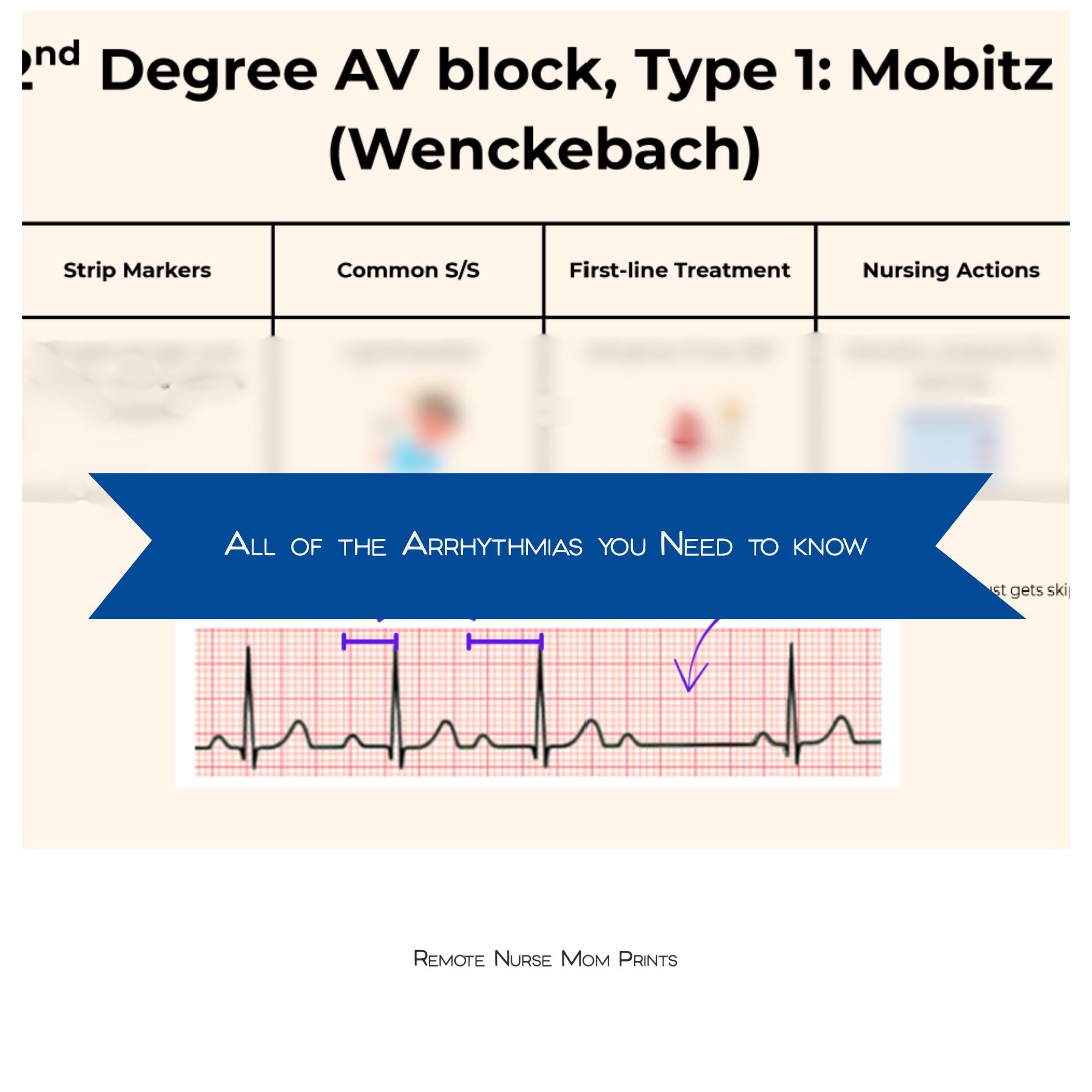 EKG & Rhythm Cheat Sheets Bundle | Printable iPad | Nursing Students ...