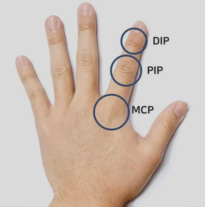 Sterling Silver Thumb Splint Ring: MCP Joint Support, Morden Jewelry ...
