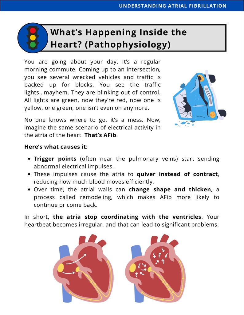 Atrial Fibrillation (afib) Guide for Patients | Stroke Risk ...