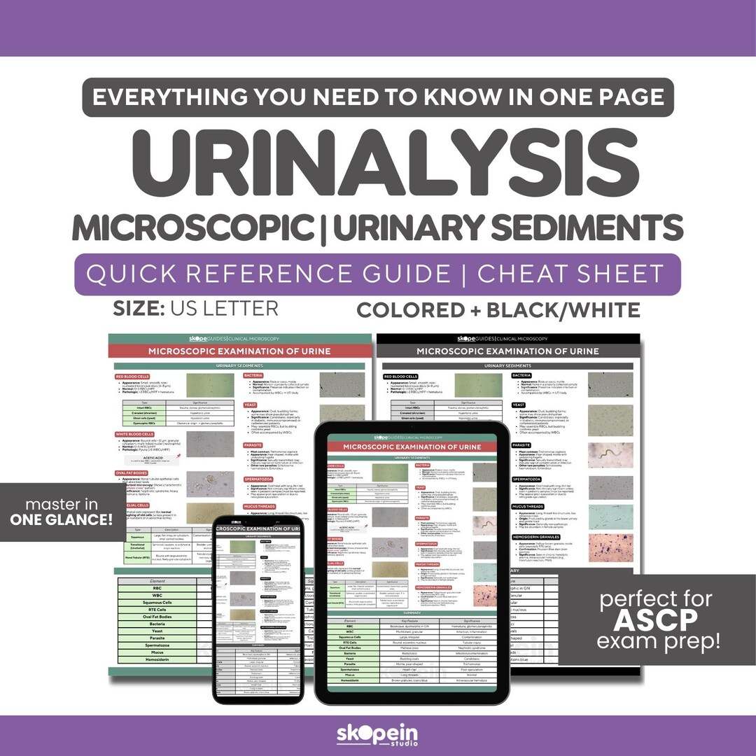Urinalysis Microscopic Exam of Urine Sediments Quick Reference Guide ...