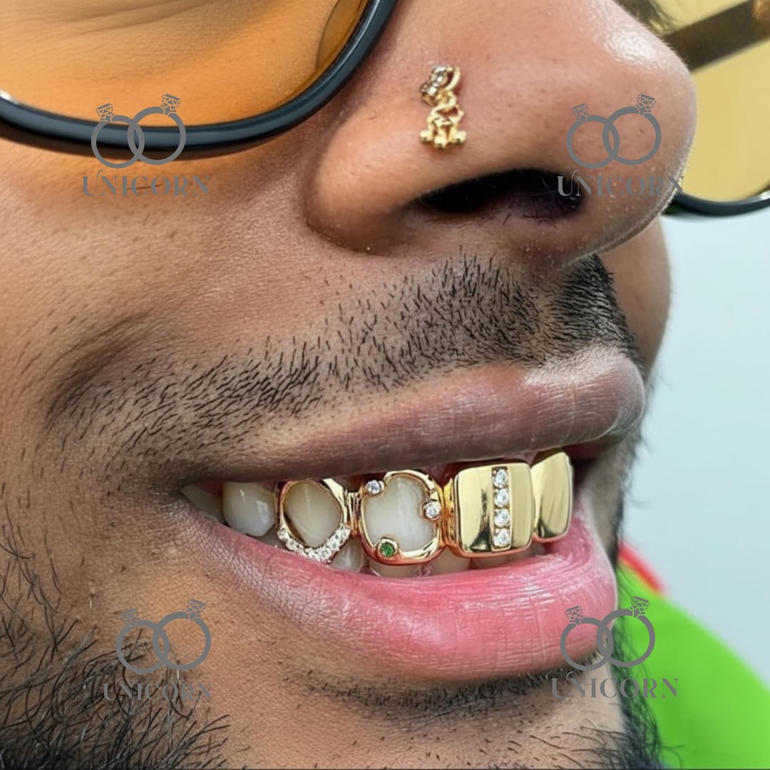 Moissanite Grillz | Custom Teeth Grills Set, 10k 14k Gold Grillz, White ...