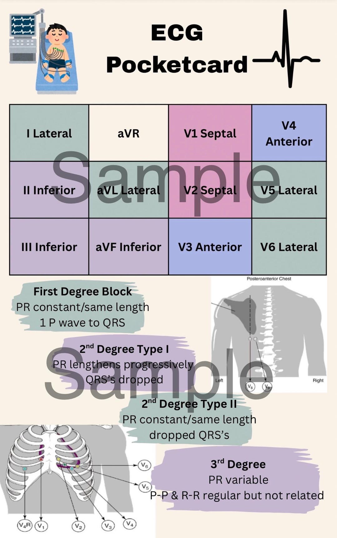 ECG Interpretation Guide Pocketcard (digital Download) - Etsy