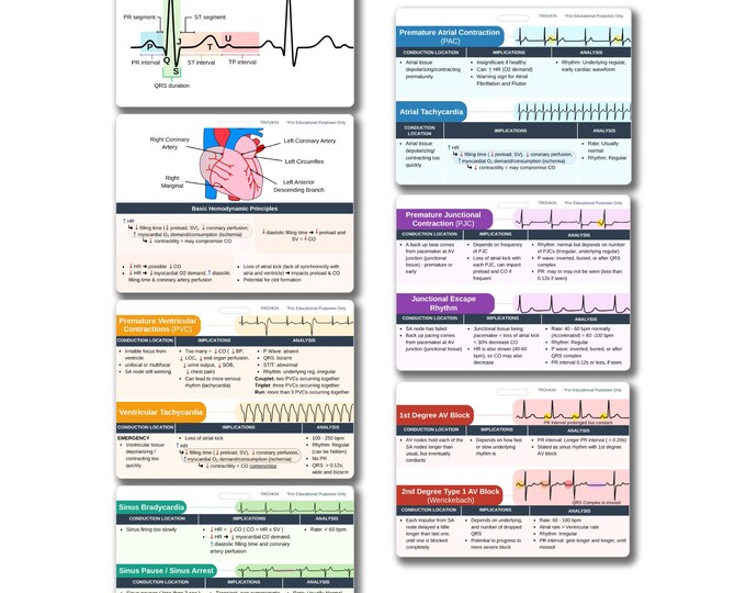 EKG Rhythm Interpretation Cards: Critical Explanations to Identify ...