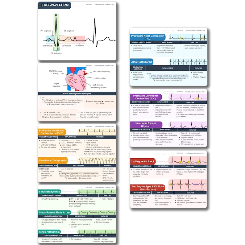 EKG Rhythm Interpretation Cards: Critical Explanations to Identify ...