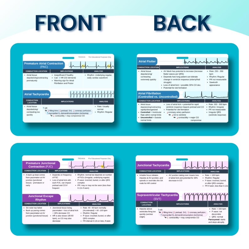 EKG Rhythm Interpretation Cards: Critical Explanations to Identify ...