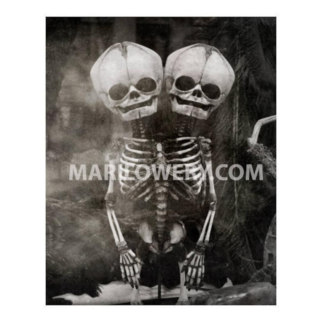 Two Headed Conjoined Skeleton 8x10 Photography Print, Black and White ...