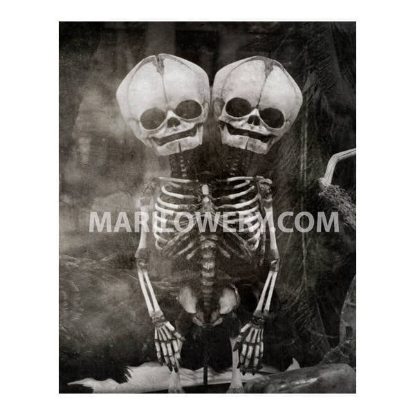 Two Headed Conjoined Skeleton 8x10 Photography Print Black | Etsy