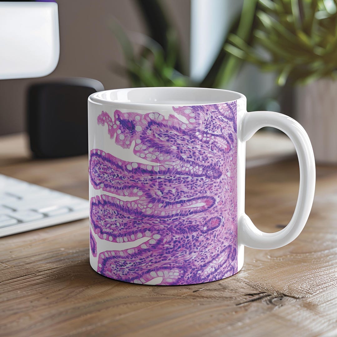 Histology Ceramic Mug, Colon H&E Pathology Anatomy Medical Lab Tech ...