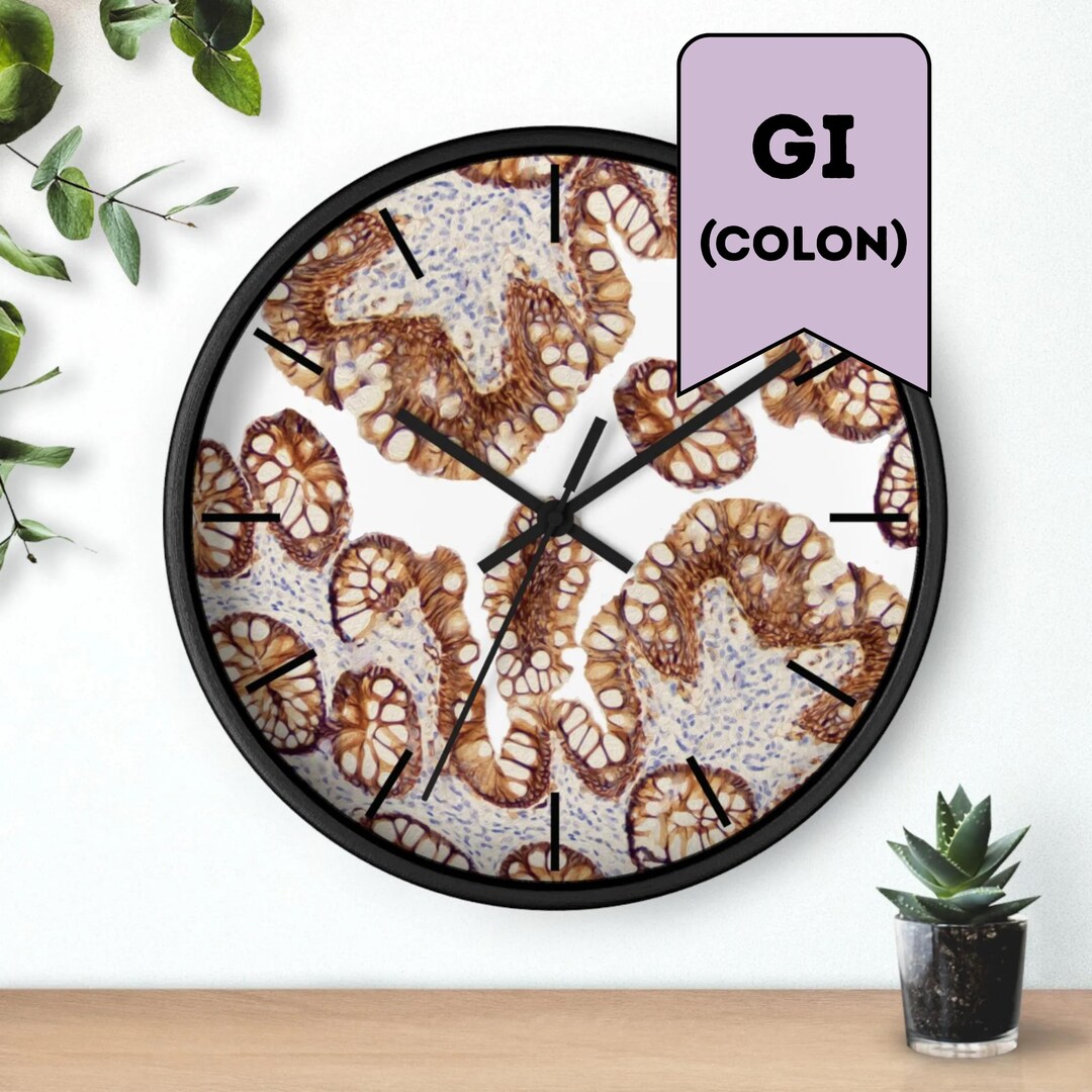 Histology Wall Clock, Pathology Stain Colon Cancer, Medical Lab Tech ...