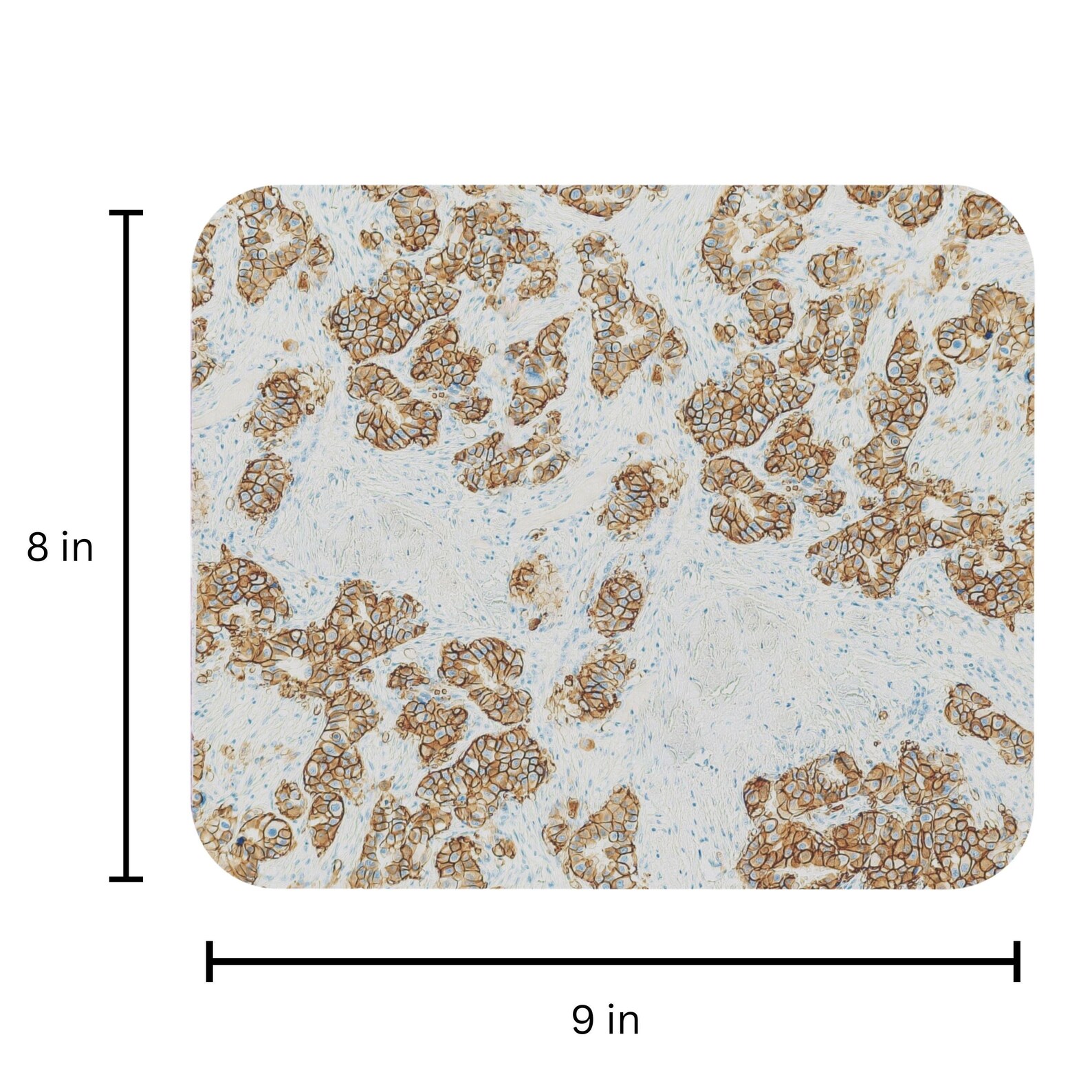Histology Mouse Pad, Her2 Breast Cancer Pathology Stain Anatomy Medical ...