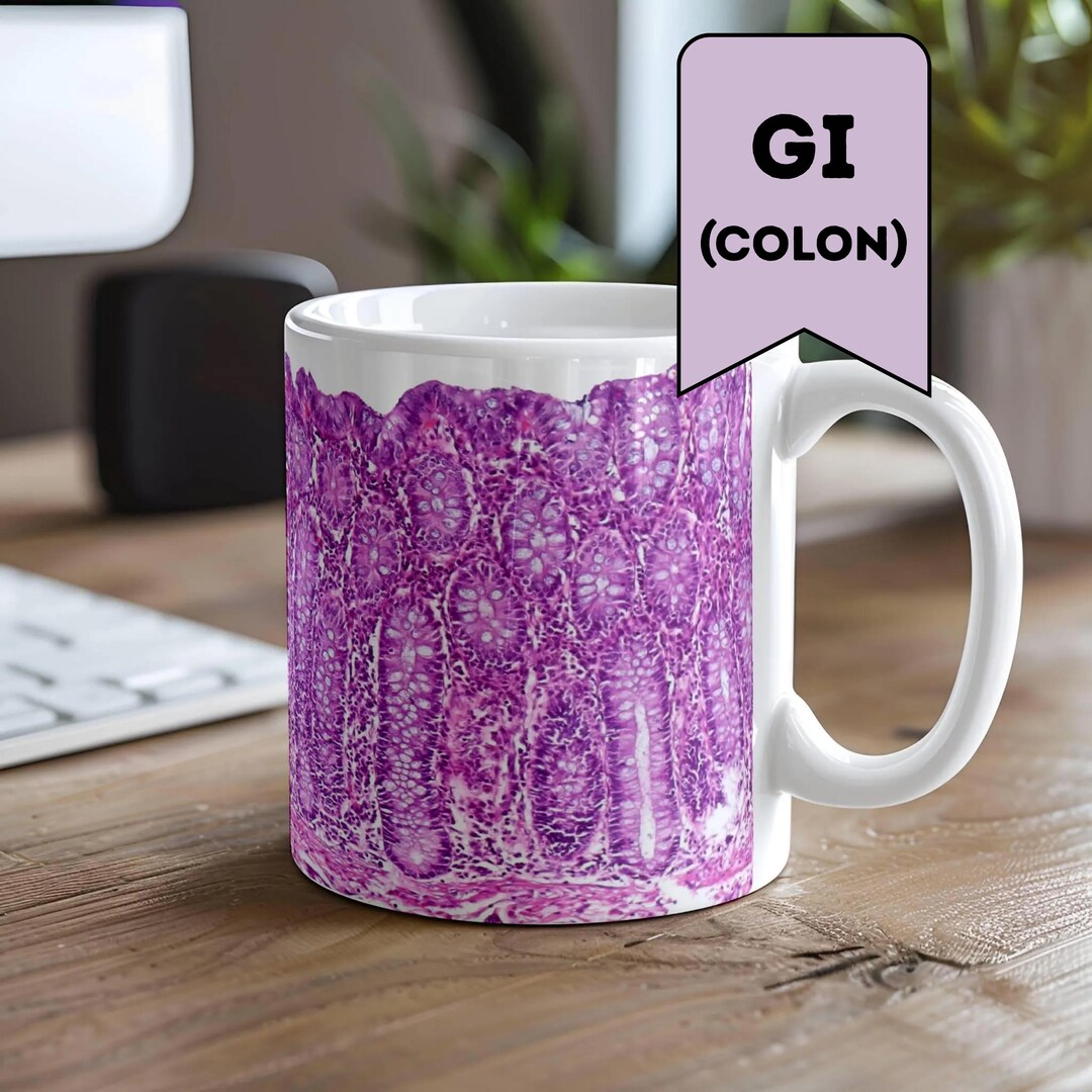 Histology Ceramic Mug, Pathology Stain Colon Anatomy, Medical Lab Tech ...