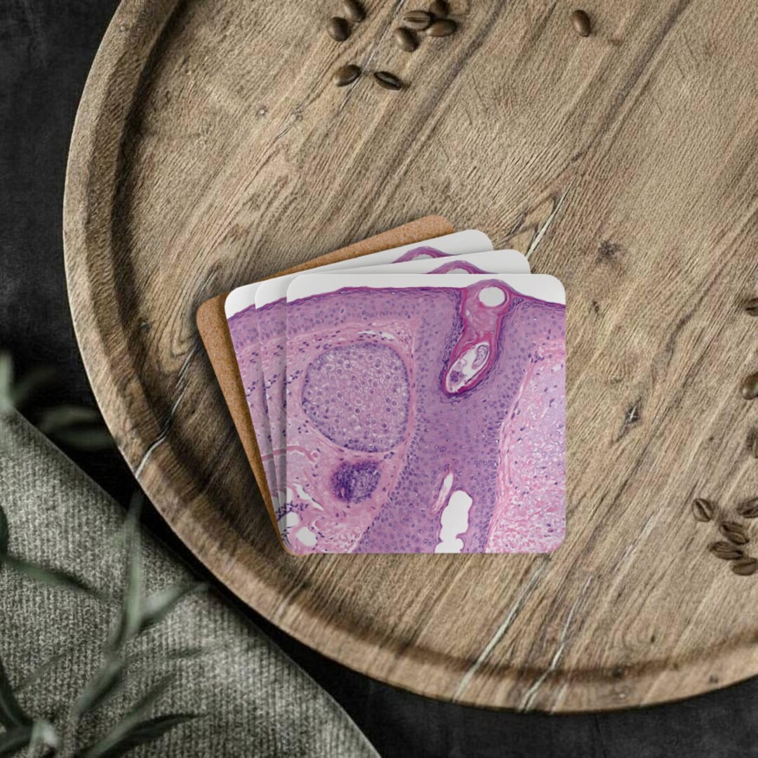 Histology Coasters, Dermatology Skin Pathology Stain, Anatomy Medical ...