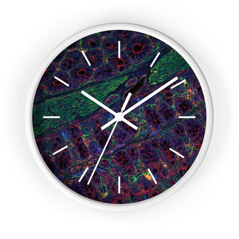 Histology Wall Clock, Fluorescent Stain Pathology Colon Anatomy Medical ...