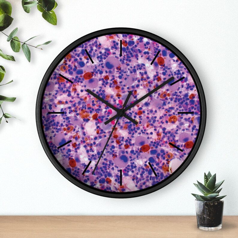 Histology Wall Clock, Hematology Pathology Stain Bone Marrow Anatomy ...