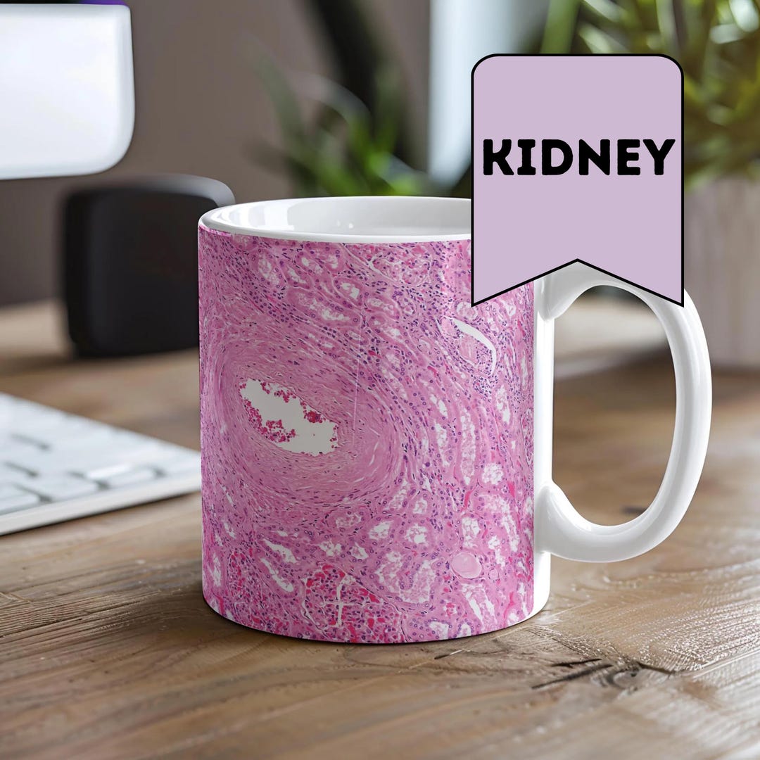 Histology Ceramic Mug, Kidney Pathology Stain, Nephrology Pathologist ...