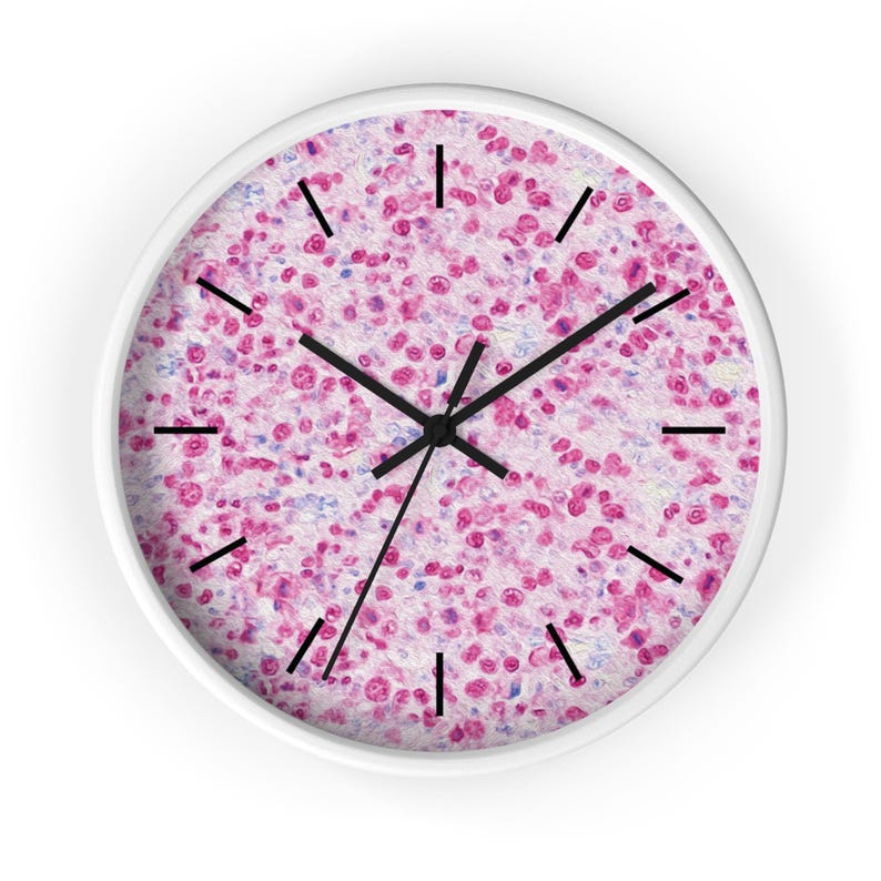 Histology Wall Clock, Hematology Pathology Stain Lymph Node ...