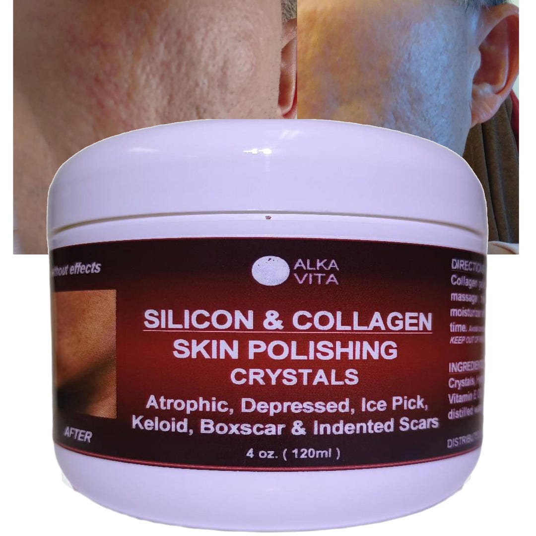 Acne Scars Silicon & Collagen Micro-crystals Skin Polishing Repair ...