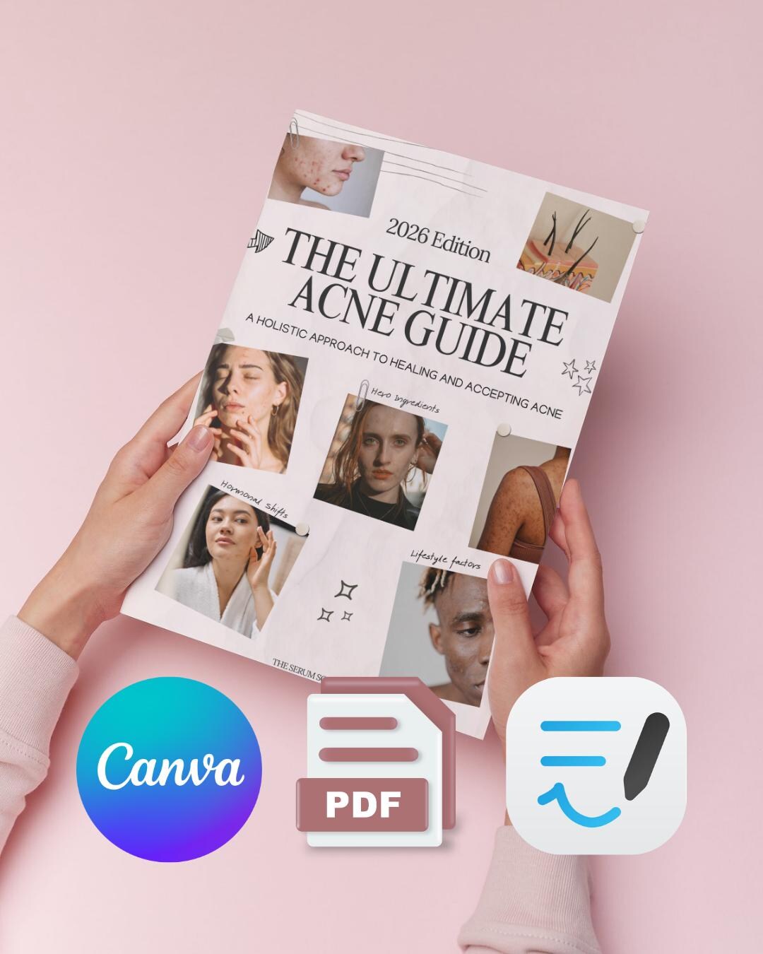 Acne Healing Guide 2026 | Holistic Skincare Routine (PDF, Canva ...