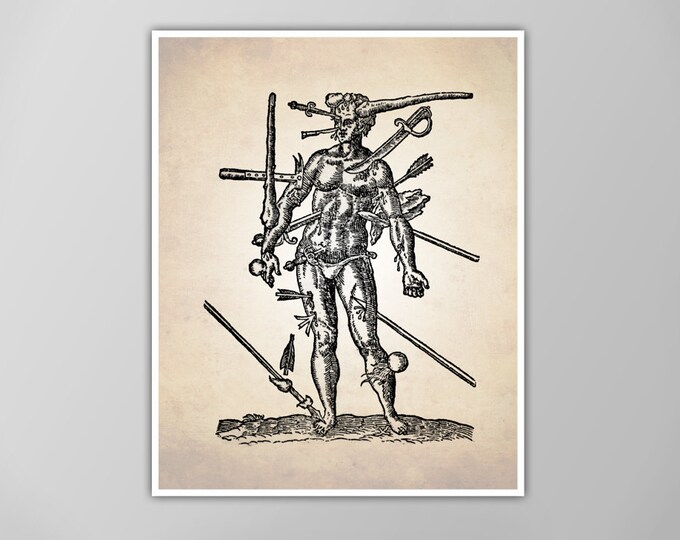 Vintage Anatomy Wounded Man Print W/ Optional Frame / High Quality ...