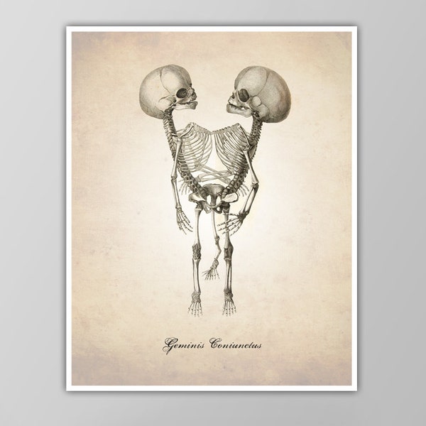 Conjoined Twins - Etsy
