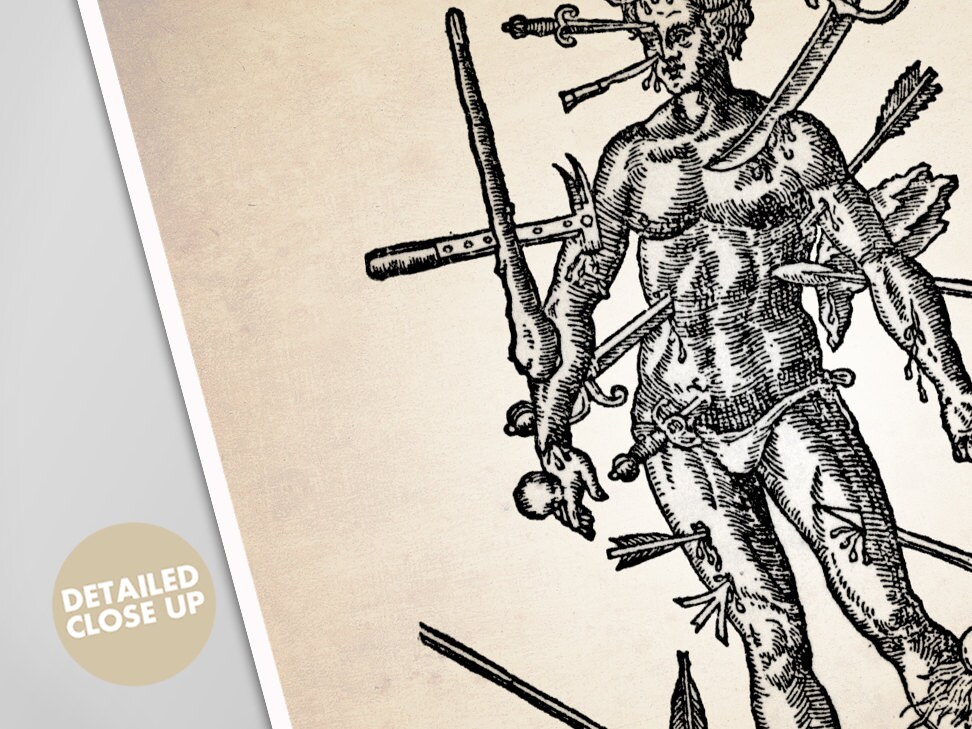 Wounds Man Art Print Human Anatomy Poster Medical - Etsy