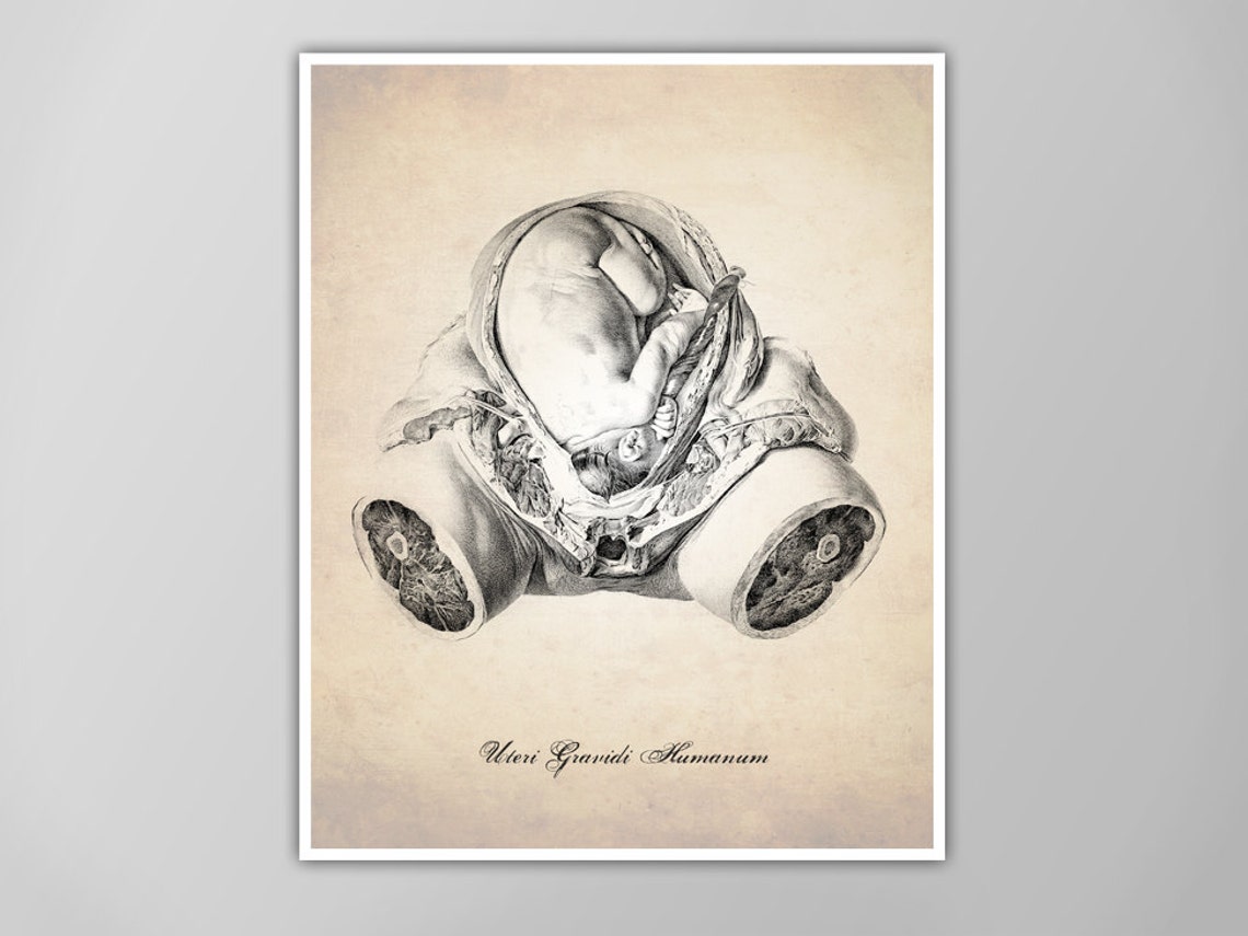 Uterus Art Print in Utero Poster Fetus in Womb - Etsy