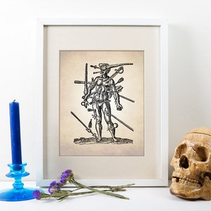 Wounds Man Art Print - Human Anatomy Poster - Medical Illustration ...