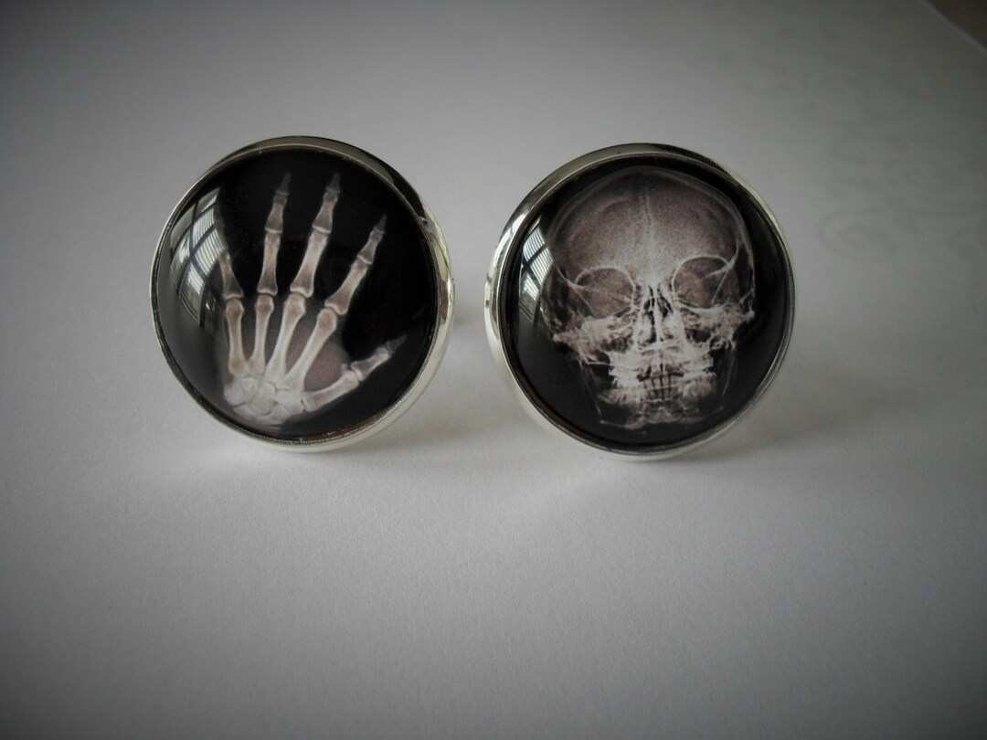 HAND & SKULL X-ray Cufflinks / Gift for Radiologist / Gift for Him ...
