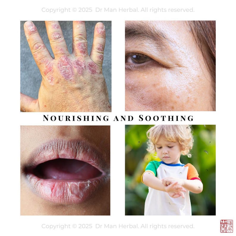 Shiunko Purple Cloud Herbal Balm – Natural Eczema & Sensitive Skin ...