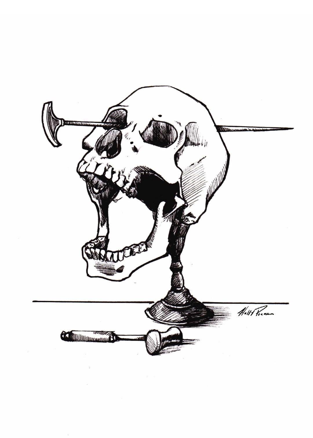 Lobotomy Art Print - Etsy