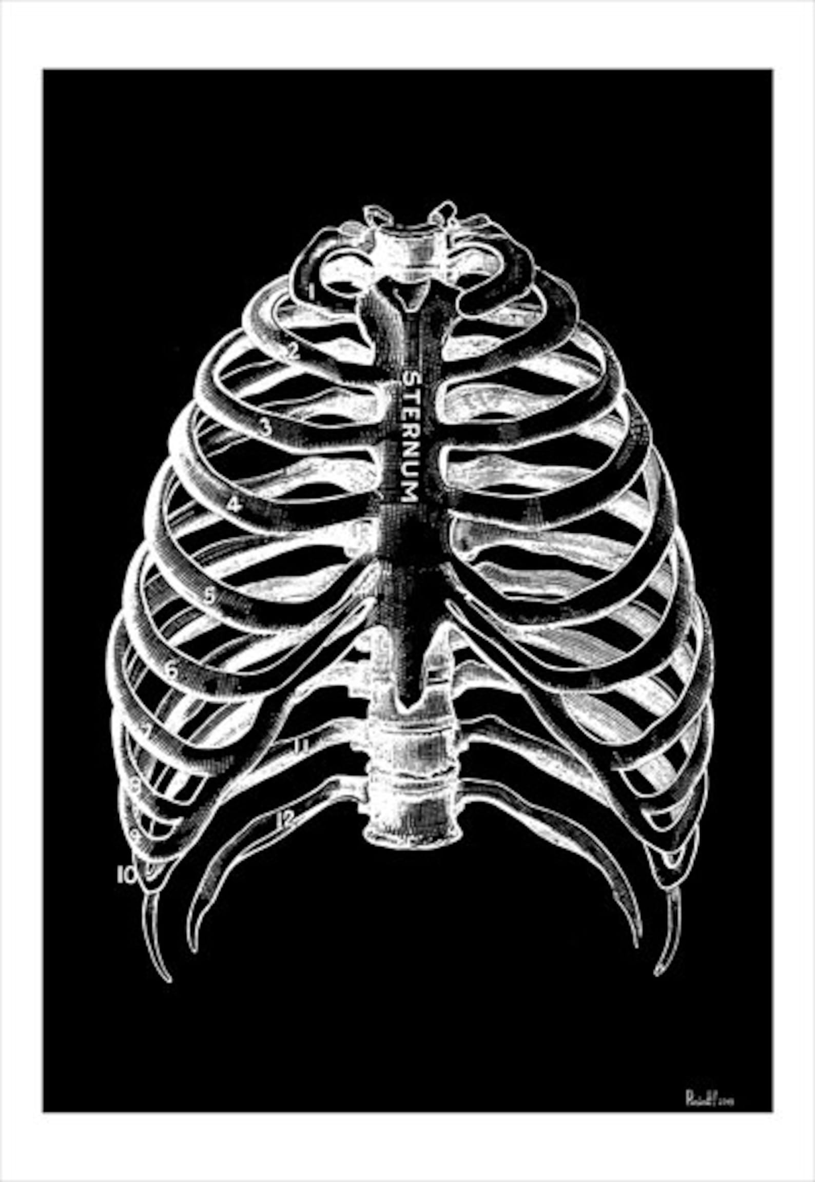 Human Rib cage black poster Anatomy Art Anatomical art | Etsy