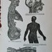Original Page 1916 MEDICAL CHART From Antique Medical Book - Etsy