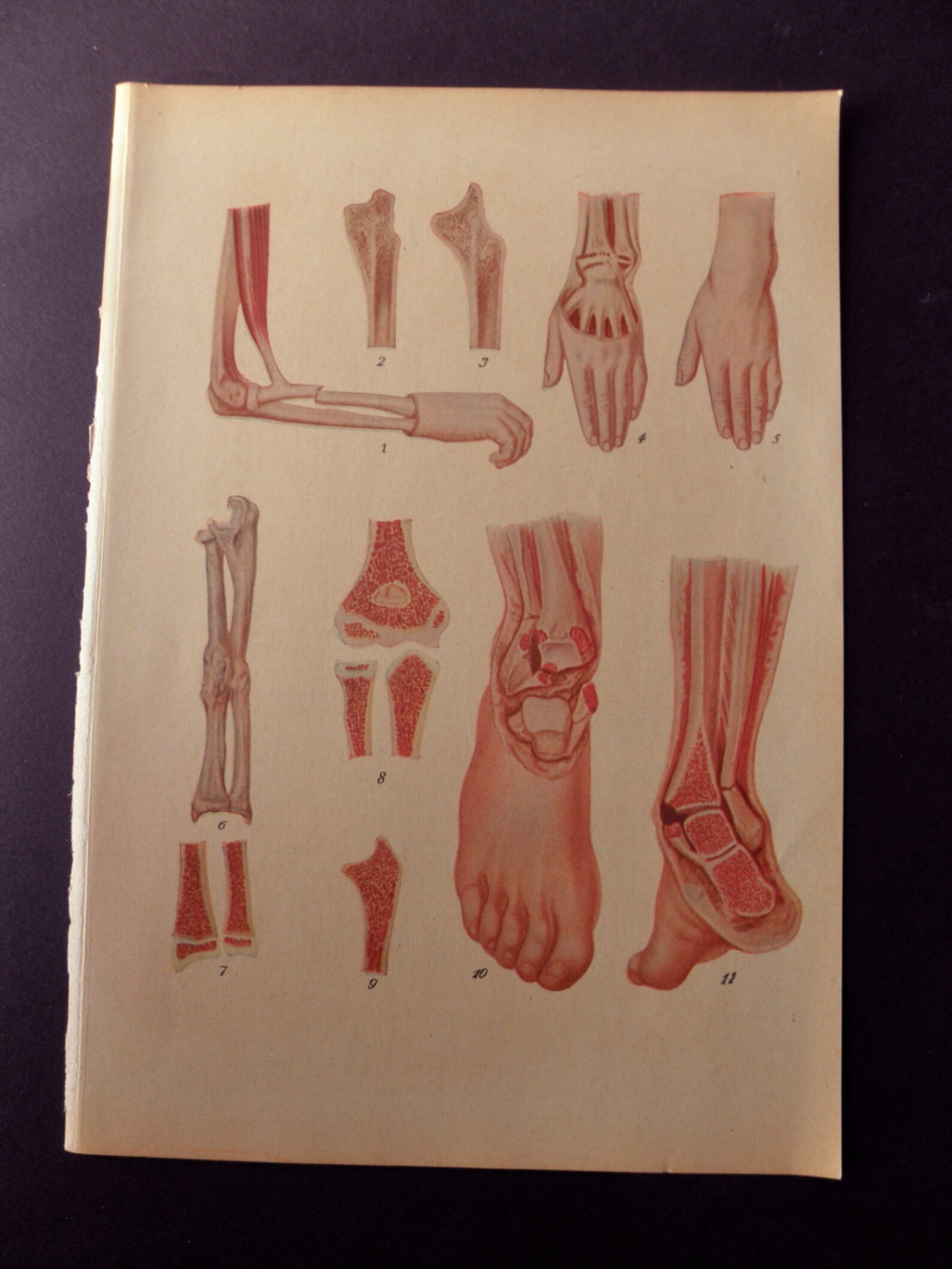 Original Page 1916 Color MEDICAL CHART From Antique Medical - Etsy