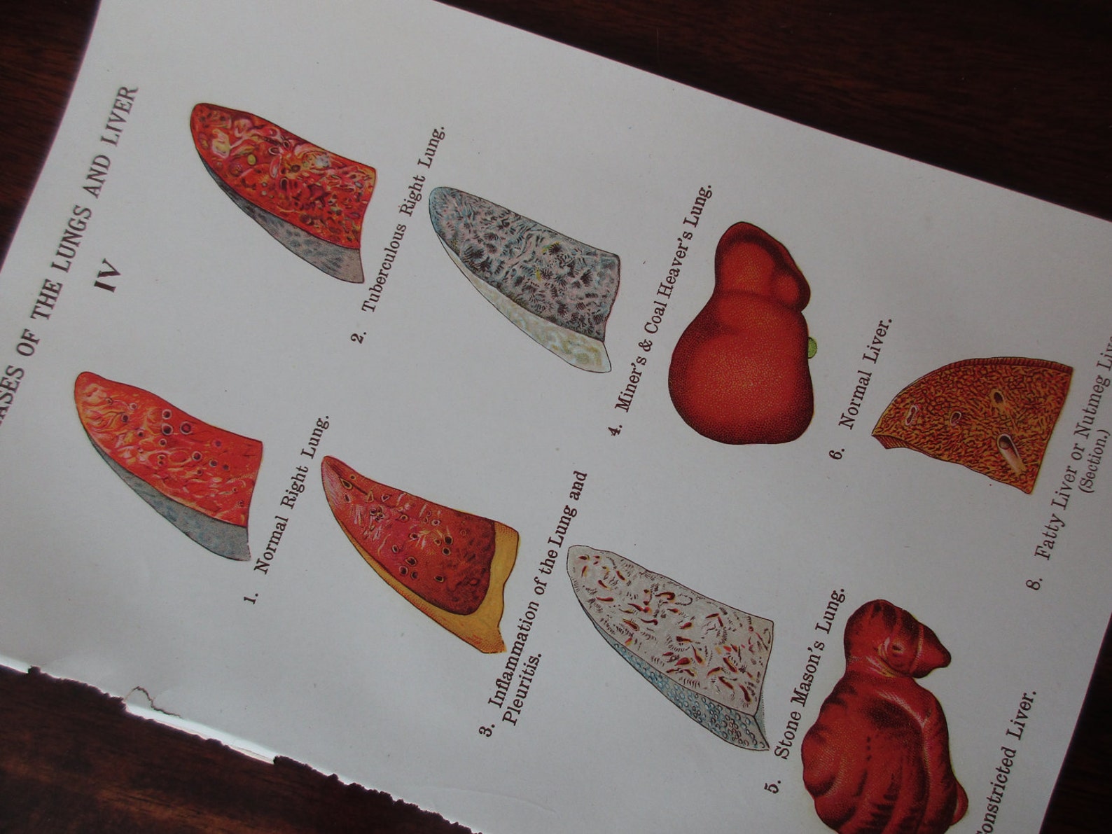 Original 1898 Color Litho MEDICAL Page From Antique Medical - Etsy