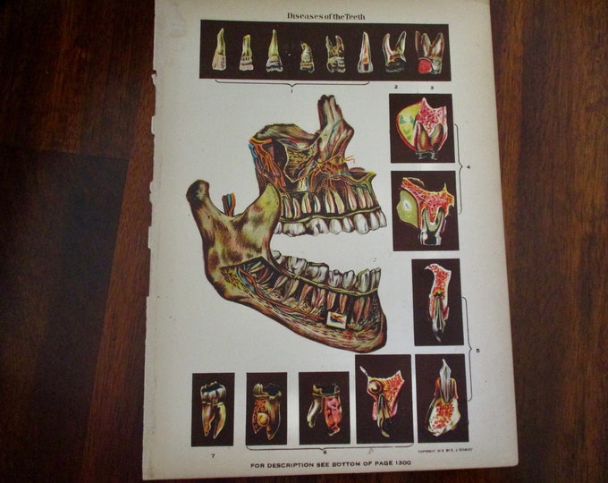 1916 Color Lithograph MEDICAL CHART From Antique Medical Book ...