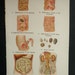 Original 1898 Color Litho MEDICAL Page From Antique Medical Book ...