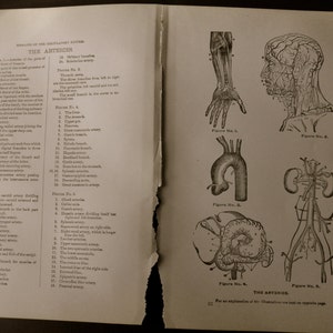 1916 MEDICAL CHART From Antique Medical Book the Arteries - Etsy