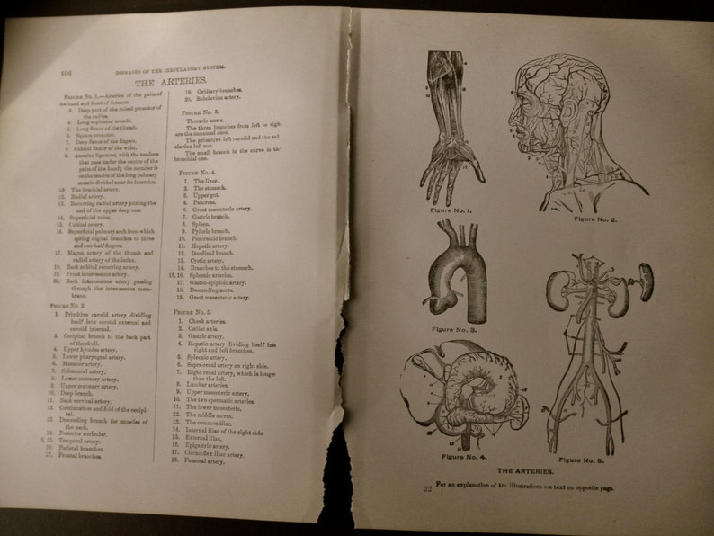 1916 MEDICAL CHART From Antique Medical Book the Arteries - Etsy