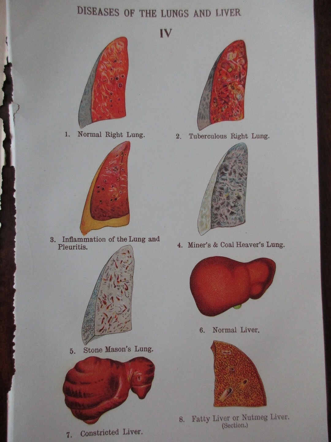 Original 1898 Color Litho MEDICAL Page From Antique Medical Book ...