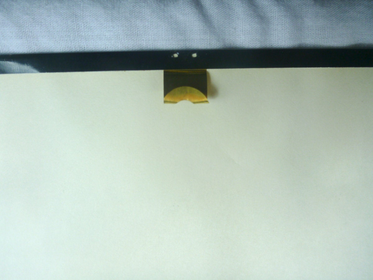 1986 Anatomical Chart Co / Spine Disorders / Wall Decor - Etsy