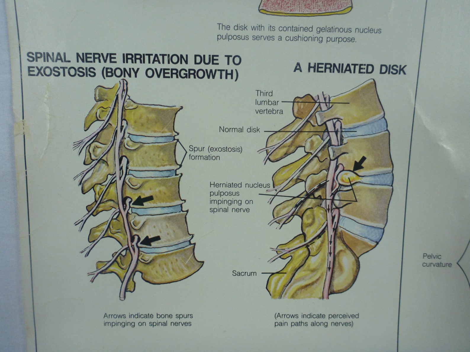 1986 Anatomical Chart Co / Spine Disorders / Wall Decor - Etsy