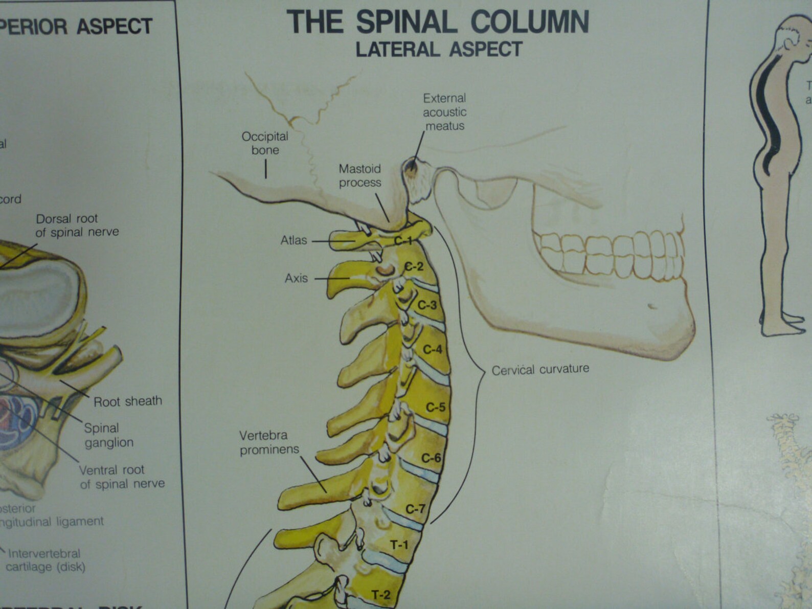 1986 Anatomical Chart Co / Spine Disorders / Wall Decor - Etsy