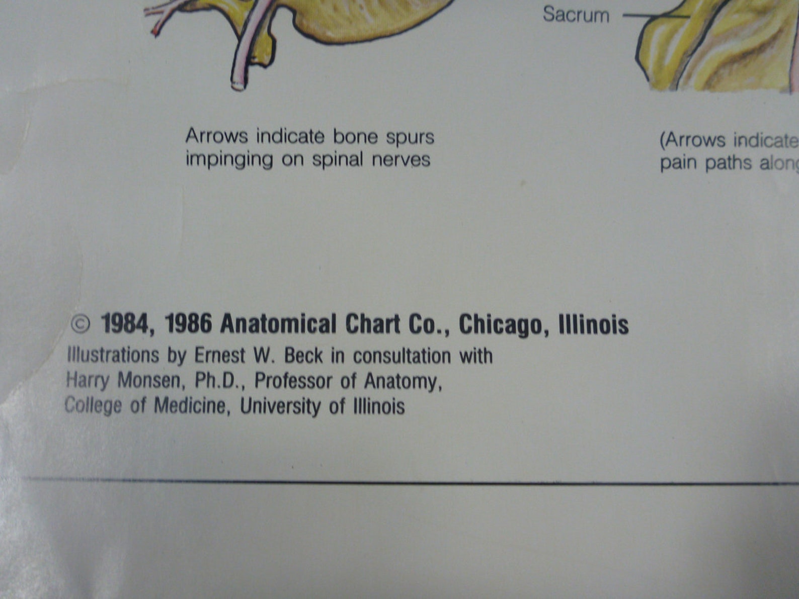 1986 Anatomical Chart Co / Spine Disorders / Wall Decor - Etsy