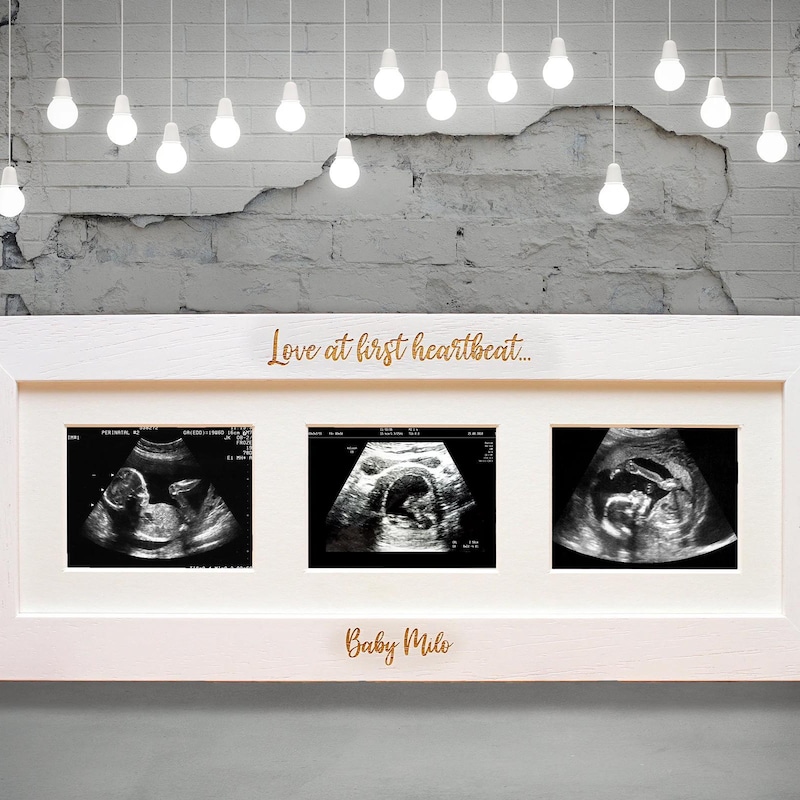 Baby Scan Frame - Etsy UK