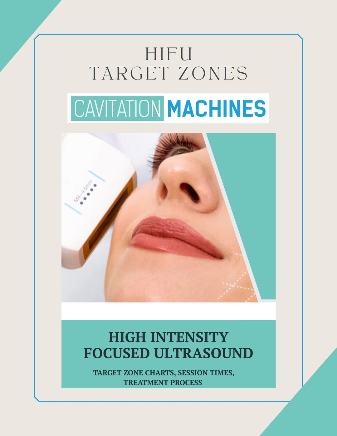Shape Tactics HIFU Target Zone Chart - Etsy